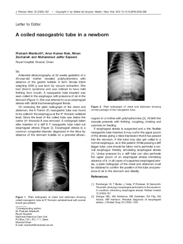 (PDF) A coiled nasogastric tube in a newborn