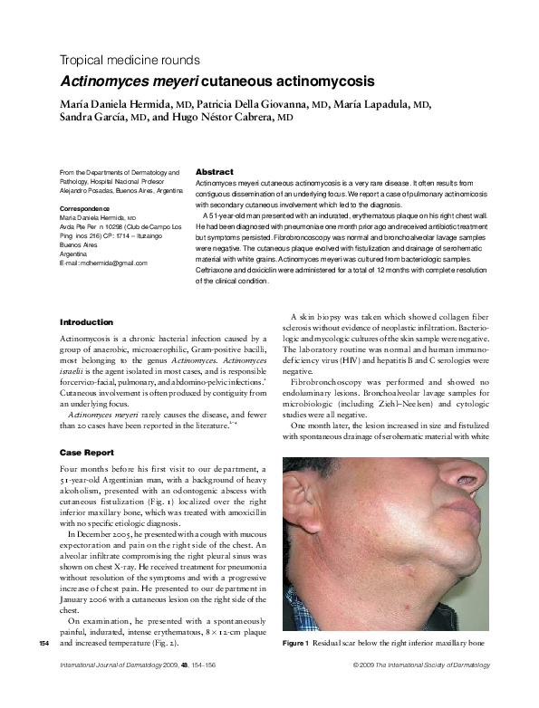 (PDF) Actinomyces meyeri cutaneous actinomycosis