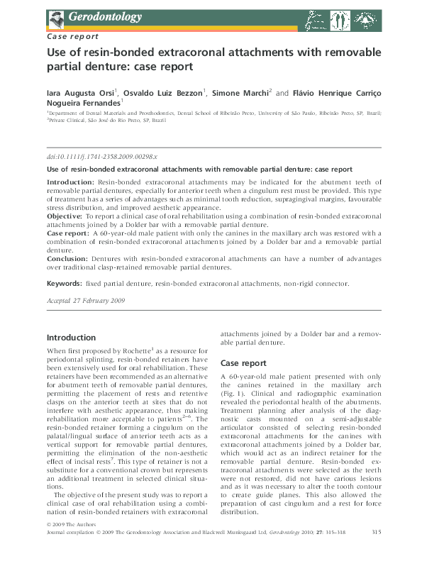 (PDF) Use of resin‐bonded extracoronal attachments with removable ...