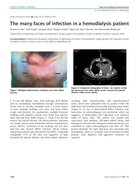 (PDF) The many faces of infection in a hemodialysis patient