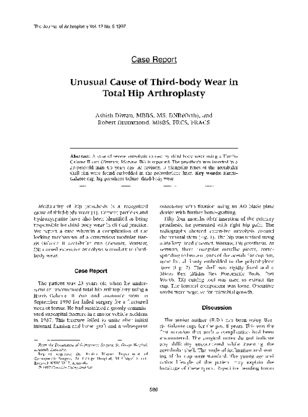 (PDF) Unusual cause of third-body wear in total hip arthroplasty