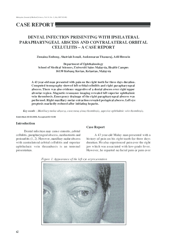 (PDF) Dental infection presenting with ipsilateral parapharyngeal ...