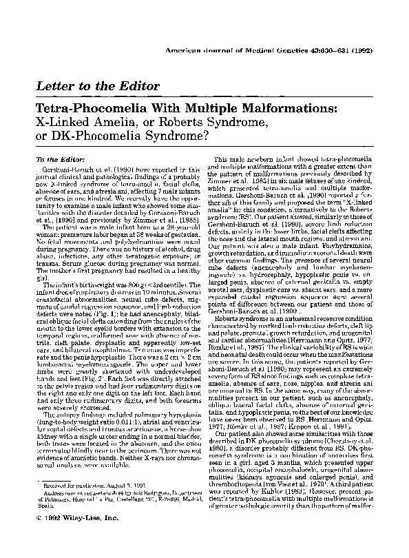 Meromelia Vs Phocomelia