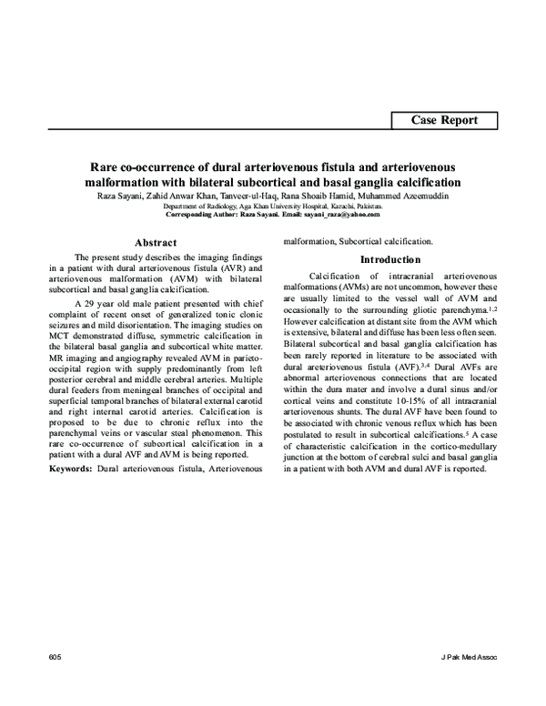 (PDF) Rare co-occurrence of dural arteriovenous fistula and ...