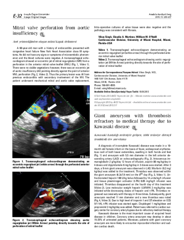 (PDF) Mitral valve perforation from aortic insufficiency