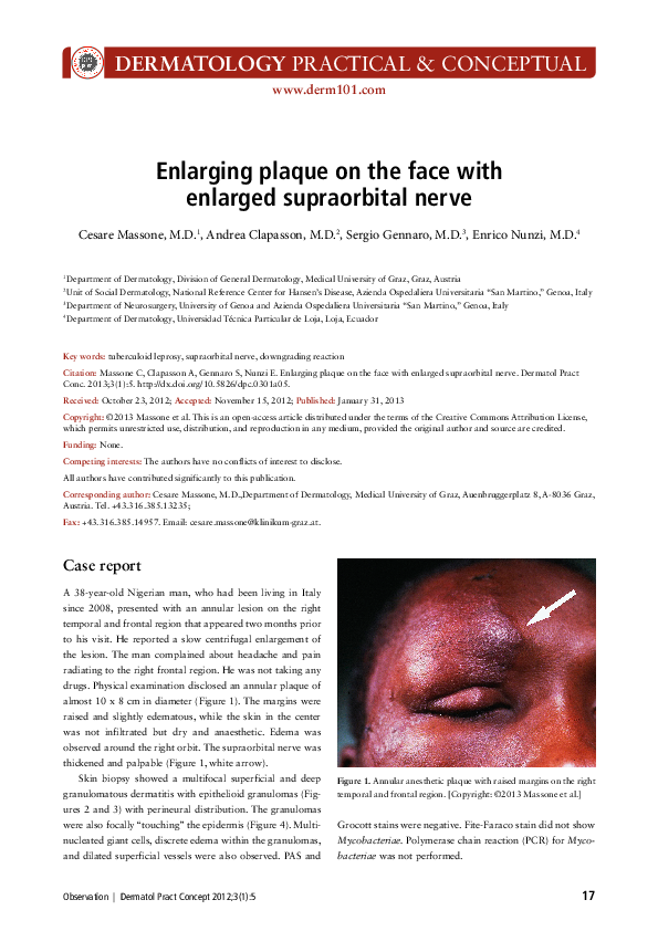 (PDF) Enlarging plaque on the face with enlarged supraorbital nerve ...
