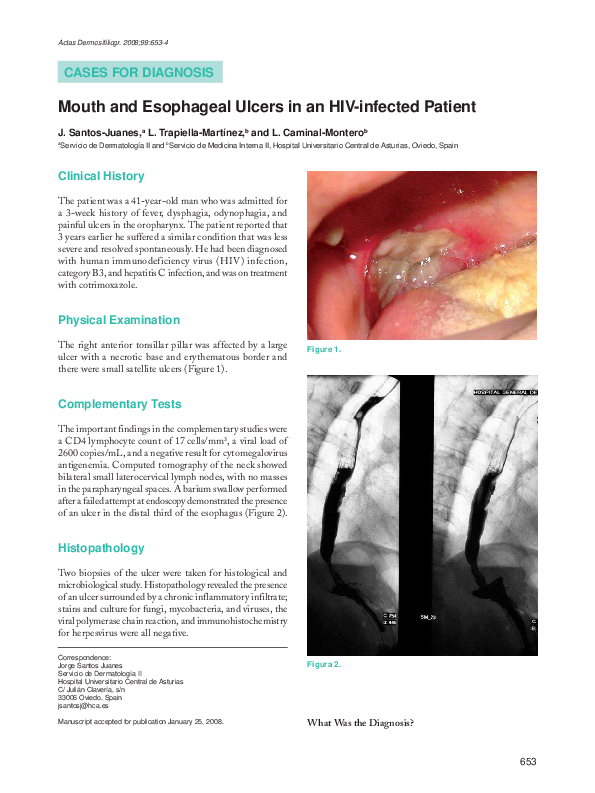 (PDF) [Mouth and esophageal ulcers in an HIV-infected patient] | Luis ...
