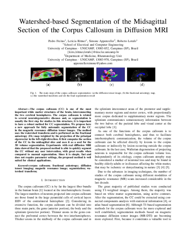 (PDF) Watershed-based Segmentation of the Midsagittal Section of the Corpus Callosum in ...