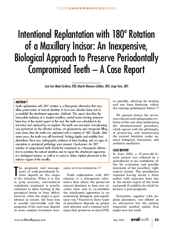 Intentional Replantation with 180º Rotation of a Maxillary Incisor: An ...