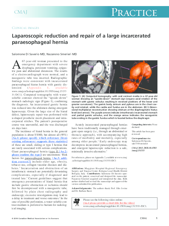 (PDF) Laparoscopic reduction and repair of a large incarcerated ...