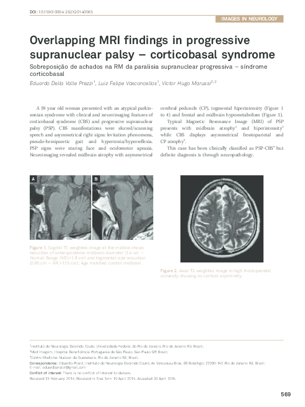 (PDF) Overlapping MRI findings in progressive supranuclear palsy ...