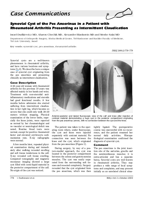 (PDF) Synovial cyst of the pes anserinus in a patient with rheumatoid ...