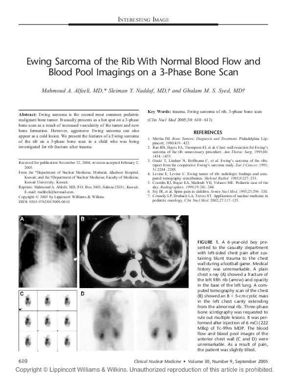 (PDF) Ewing Sarcoma of the Rib With Normal Blood Flow and Blood Pool ...