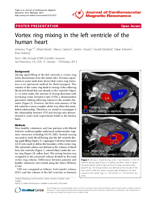 (PDF) Vortex ring mixing in the left ventricle of the human heart
