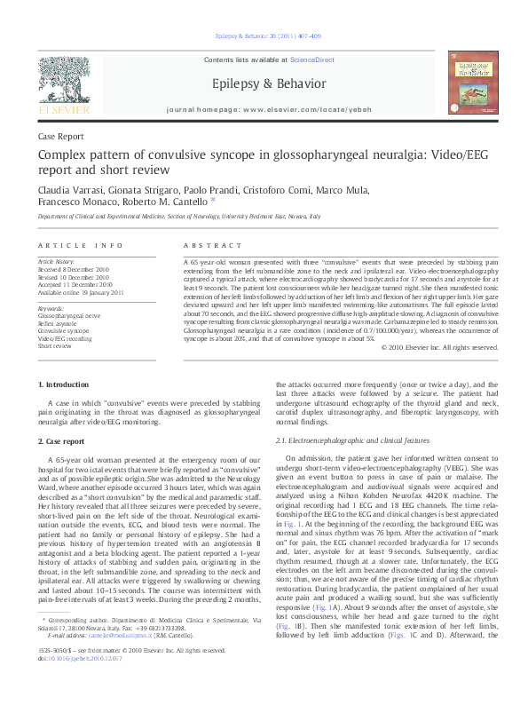 (PDF) Complex pattern of convulsive syncope in glossopharyngeal ...