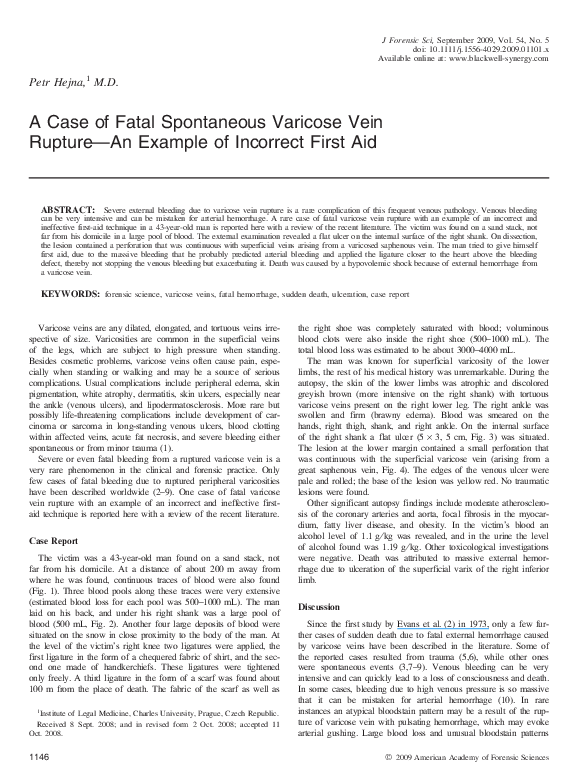 (PDF) A Case of Fatal Spontaneous Varicose Vein Rupture-An Example of ...