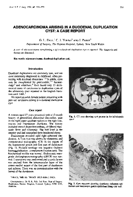 (PDF) Adenocarcinoma Arising in a Duodenal Duplication Cyst a Case Report