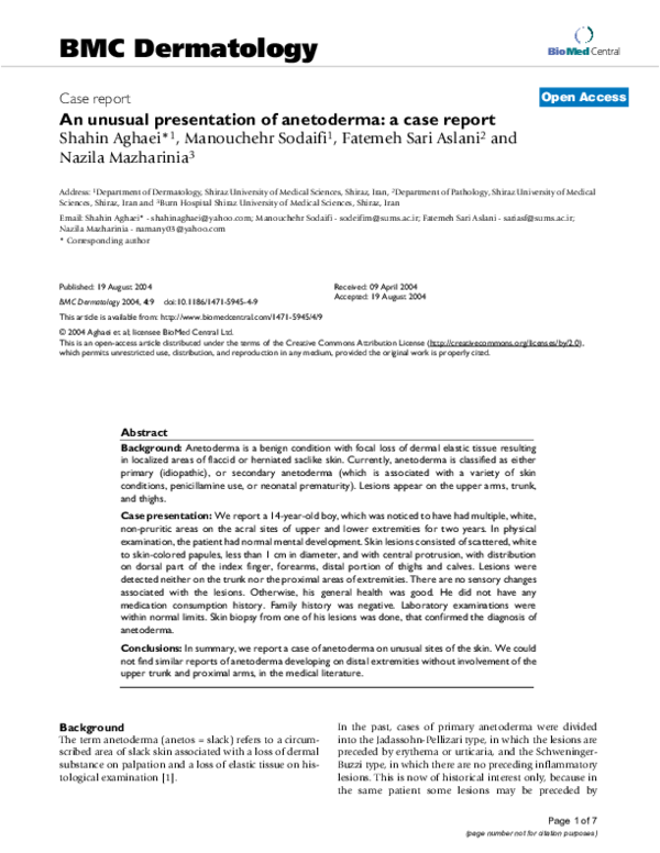 (PDF) An unusual presentation of anetoderma: a case report