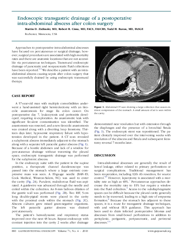 (PDF) Endoscopic transgastric drainage of a postoperative intra ...