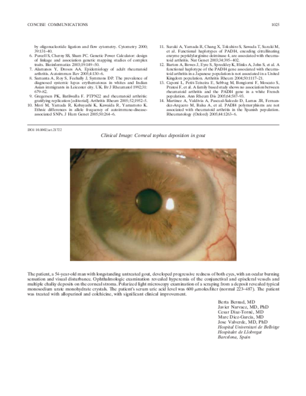 (PDF) Clinical image: corneal tophus deposition in gout
