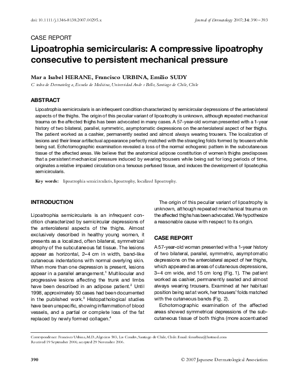 (PDF) Lipoatrophia semicircularis: A compressive lipoatrophy ...