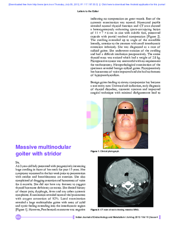 (PDF) Massive multinodular goiter with stridor