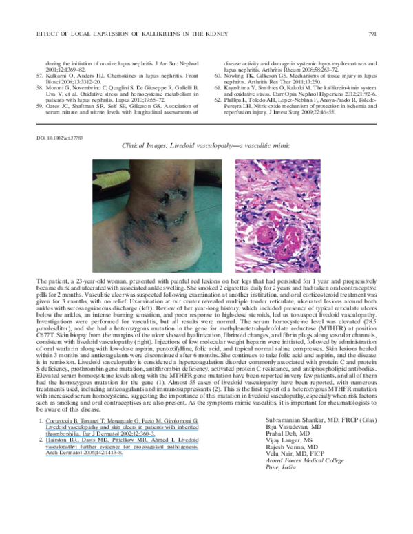 (PDF) Livedoid vasculopathy-a vasculitic mimic