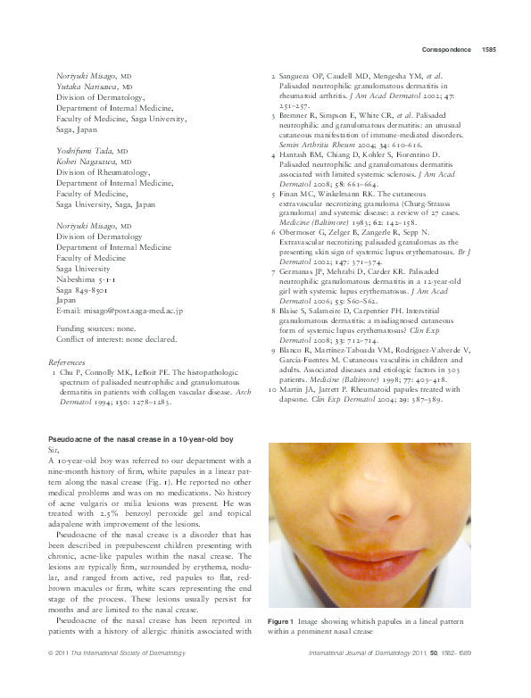 (PDF) Pseudoacne of the nasal crease in a 10-year-old boy