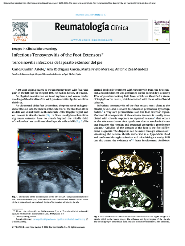 (PDF) Infectious Tenosynovitis of the Foot Extensors
