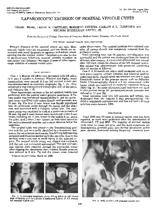 (PDF) LAPAROSCOPIC EXCISION OF SEMINAL VESICLE CYSTS