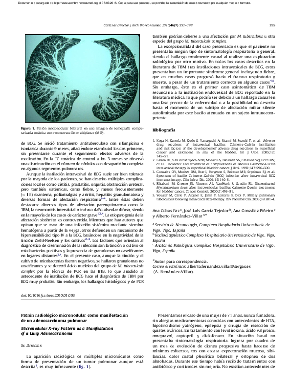 (PDF) Patrón radiológico micronodular como manifestación de un ...