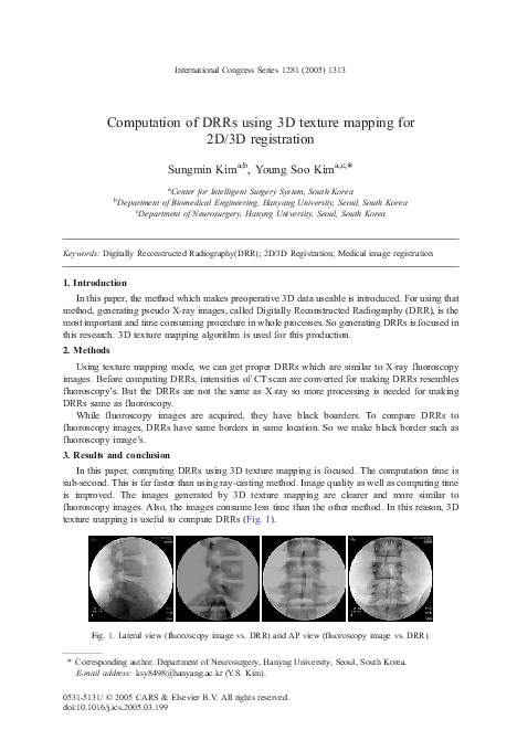 (PDF) Computation of DRRs using 3D texture mapping for 2D/3D registration