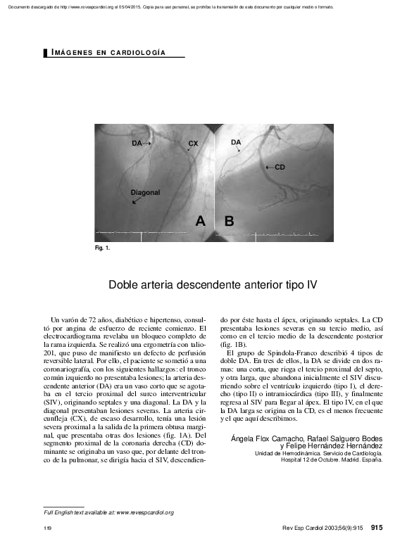 (PDF) Doble arteria descendente anterior tipo IV