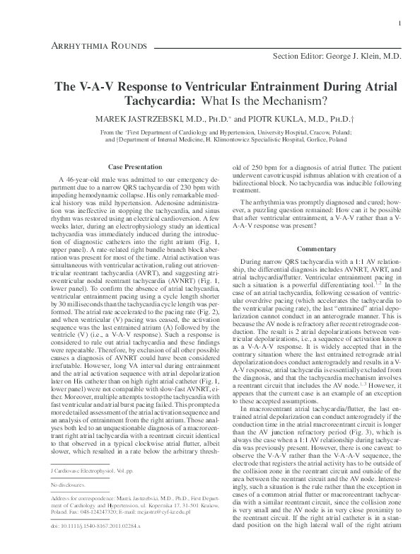 (PDF) The V-A-V Response to Ventricular Entrainment During Atrial ...
