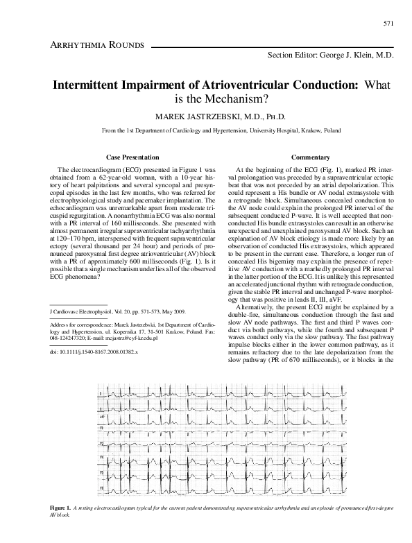 (PDF) Intermittent Impairment of Atrioventricular Conduction: What is ...