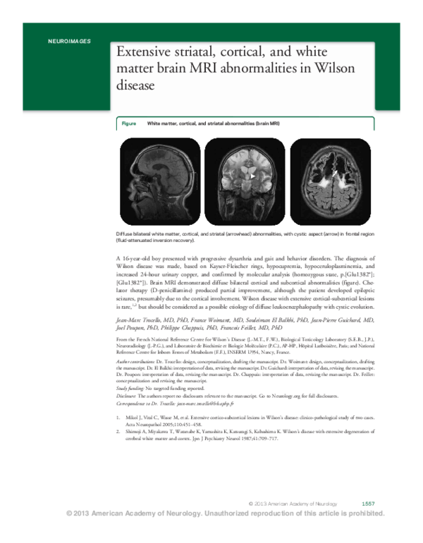 (PDF) Extensive striatal, cortical, and white matter brain MRI ...