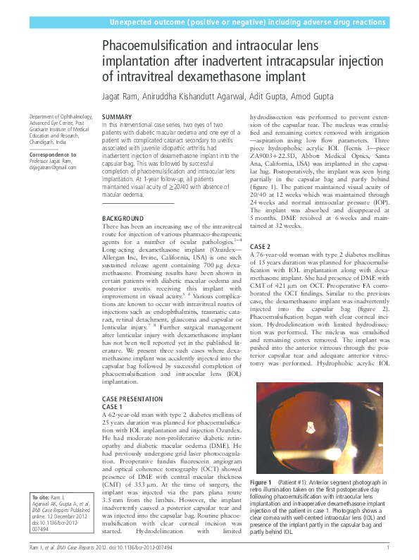 (PDF) Phacoemulsification and intraocular lens implantation in Alport ...