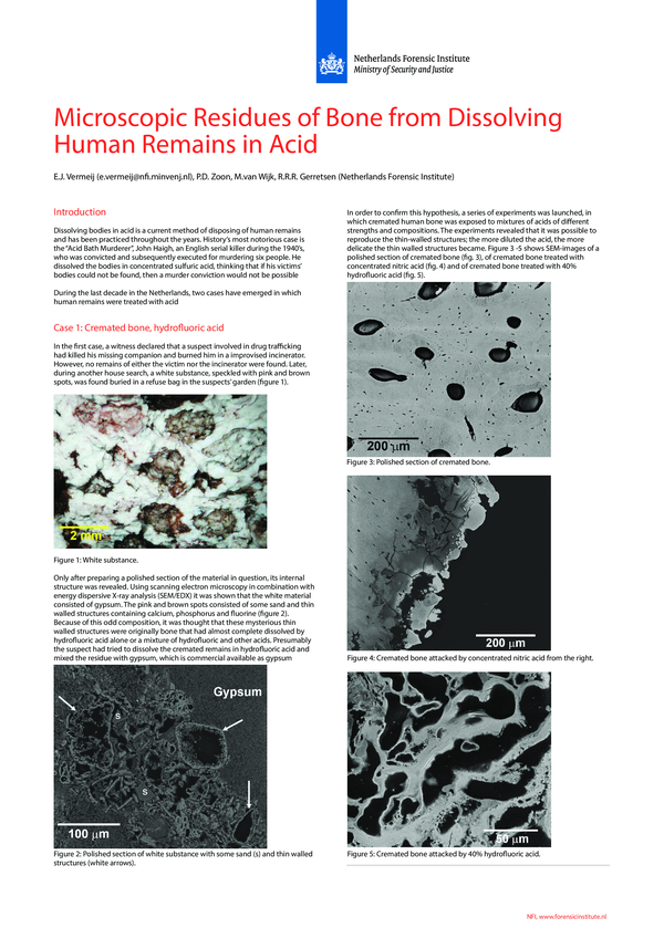 (PDF) Microscopic Residues of Bone from Dissolving Human Remains in Acids