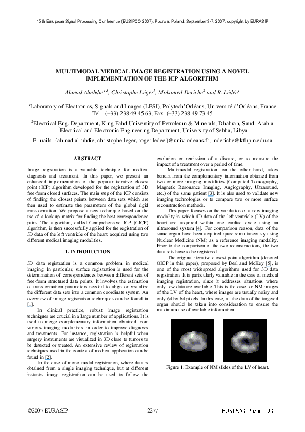 (PDF) Multimodal Medical Image Registration Using a Novel Implementation of the Icp Algorithm