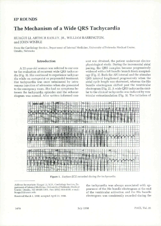 (PDF) Wide QRS Complex Tachycardia in a 68-Year-Old Man | Ilan Rabey ...