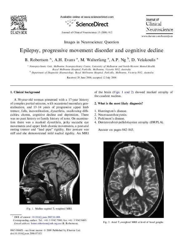 (PDF) Epilepsy, progressive movement disorder and cognitive decline | Mark Walterfang - Academia.edu