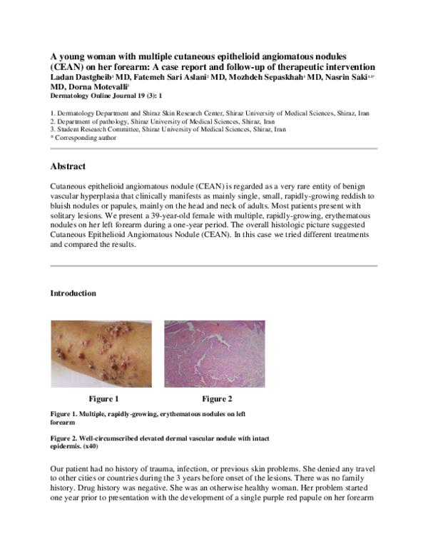 (PDF) An asymptomatic nodule on the forearm | YUNUS EMRE TOPAL ...