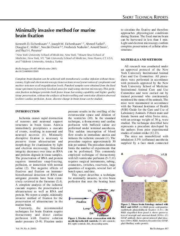 (PDF) Minimally invasive method for murine brain fixation