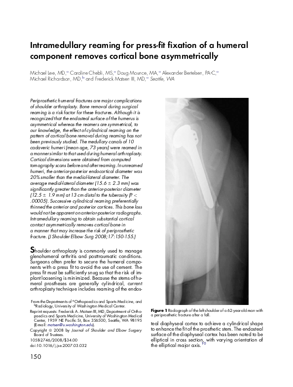 (PDF) Intramedullary reaming for press-fit fixation of a humeral ...