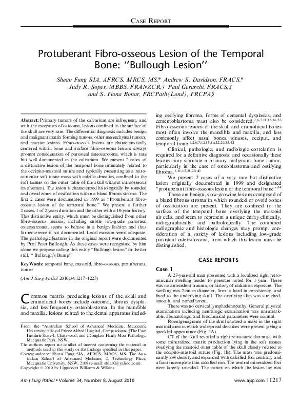 (PDF) Protuberant Fibro-osseous Lesion of the Temporal Bone: “Bullough ...