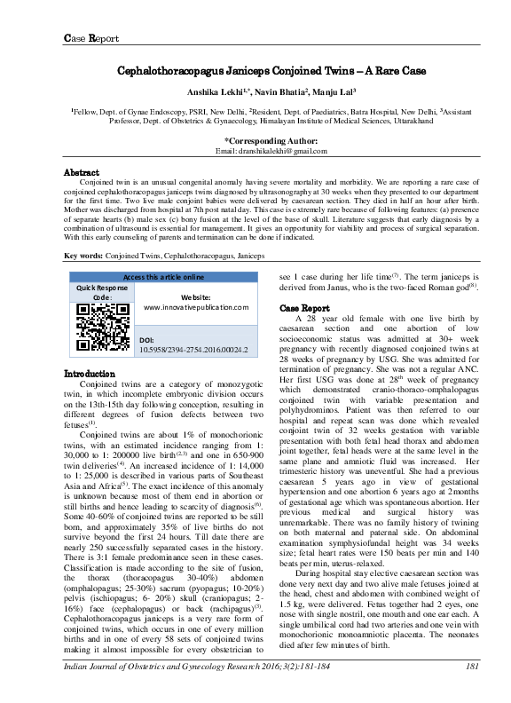 (PDF) Cephalothoracopagus Janiceps Conjoined Twins – A Rare Case | IP ...