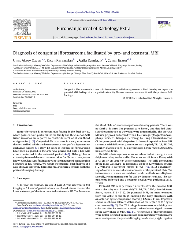 (PDF) Diagnosis of congenital fibrosarcoma facilitated by pre- and ...