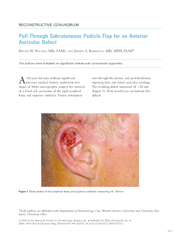 (PDF) Pull-Through Subcutaneous Pedicle Flap for an Anterior Auricular ...