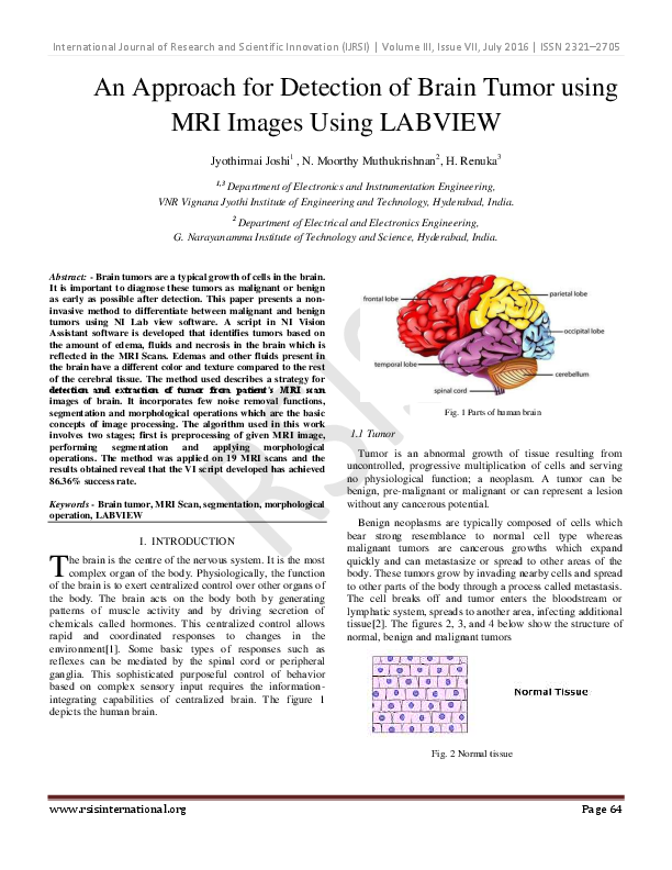 (PDF) MRI Brain Tumor Detection with LabVIEW