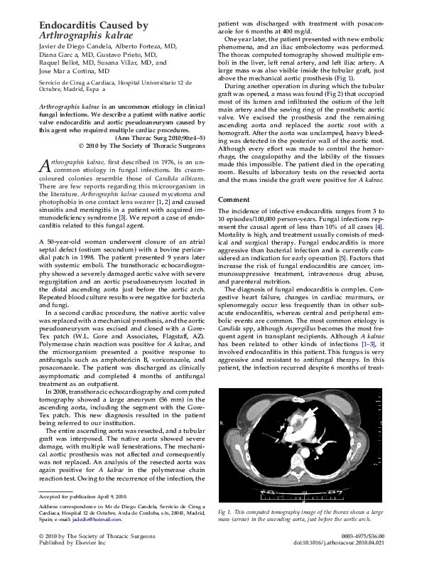 (PDF) Endocarditis Caused by Arthrographis kalrae